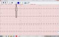 Curso de ECG com WINCARDIO | Aprenda fazer o exame na pratica