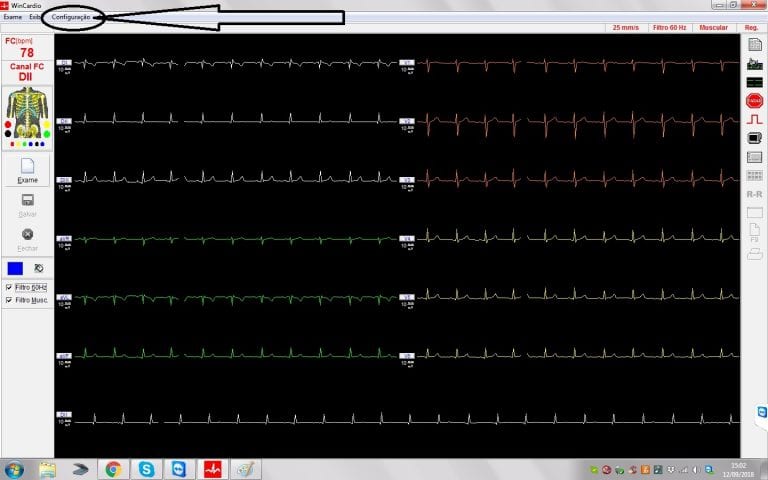 Curso de ECG com WINCARDIO | Aprenda fazer o exame na pratica