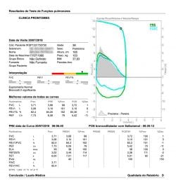 Espirometria: para que serve e como é feita?