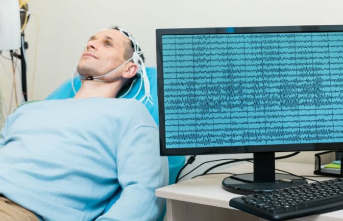 Eletroencefalograma digital: como e por que solicitar?