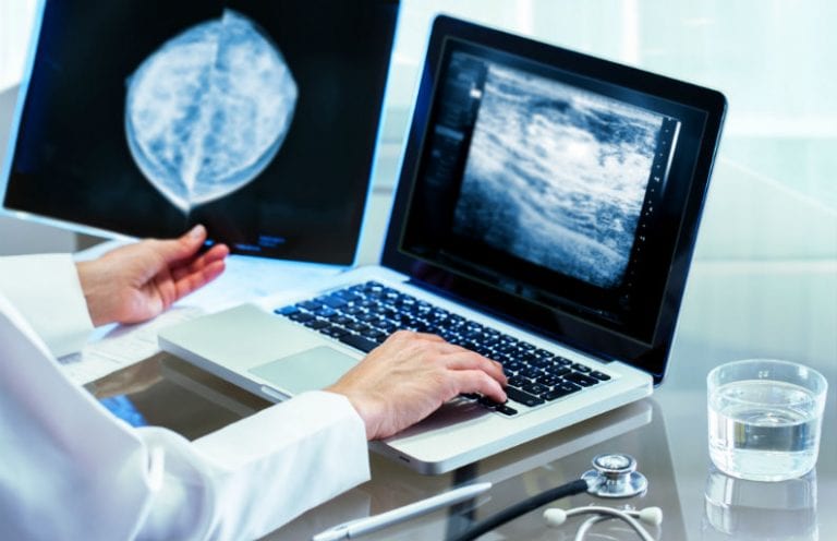 Segredo para laudar mamografia com maior precisão