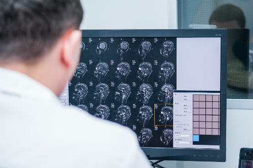 Como escolher o melhor aparelho de ressonância magnética para ...