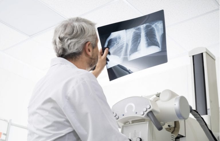 Interpretação de raio X: princípios básicos para interpretar radiografia