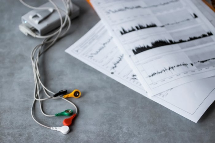 Como interpretar resultados do Holter 24 horas: exame normal e anormal