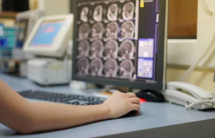 Neurorradiologia: o que é, áreas e exames