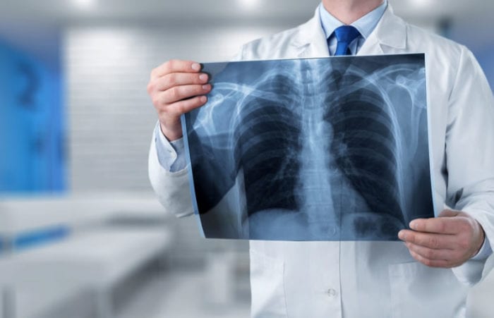 Radiologia e radiografia: qual diferença e a importância para sociedade