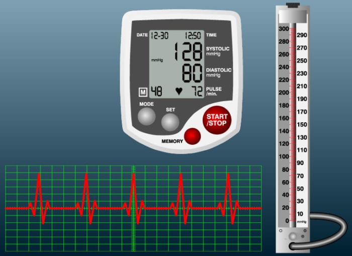 Como interpretar MAPA 24 horas: resultados e valores de referência