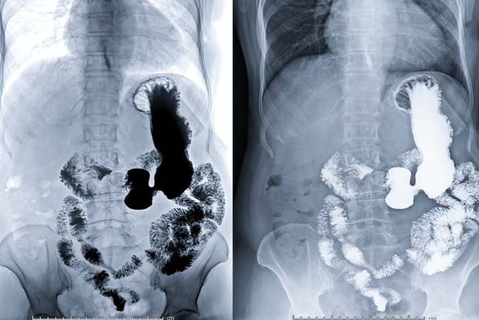 Fluoroscopia: o que é esse exame e para que serve?