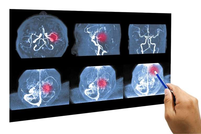 Angioressonância magnética: saiba tudo sobre este exame