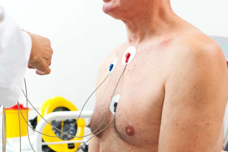 Holter Micromed: o que é e como funciona o aparelho?