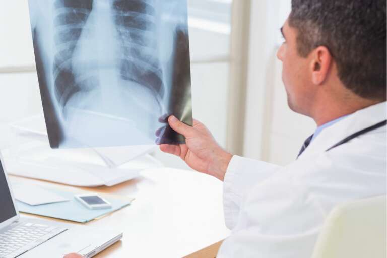 Pneumotórax no raio X: como identificar a condição?
