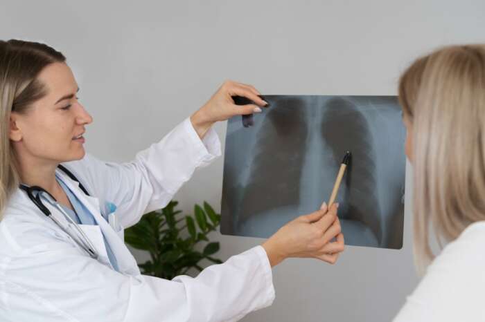 Raio X e tuberculose: como funciona o diagnóstico?
