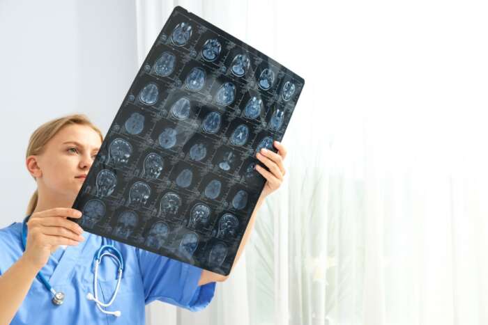 Desafios e soluções para serviços de teleneurologia